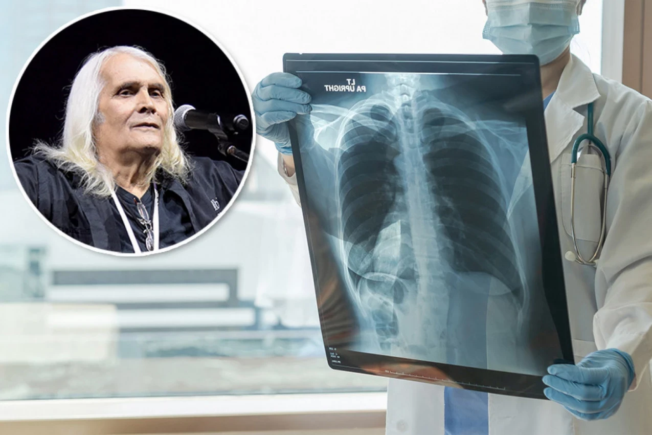 БОРА ЧОРБА Е БОЛЕН ОД ОВА - ШТО Е ОПСТРУКТИВНА БЕЛОДРОБОСТ? Познатиот ...